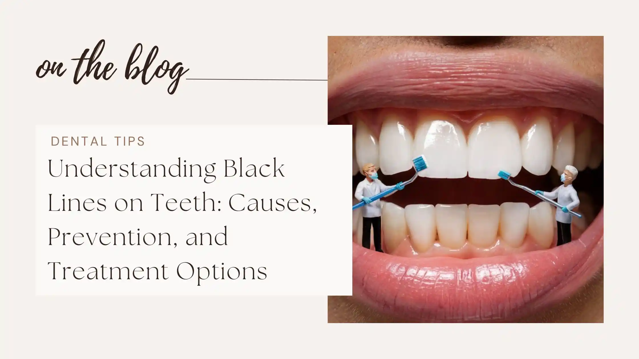 Black Lines on Teeth: Causes, Prevention, and Effective Treatments ...